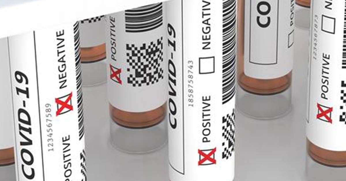 Links in the COVID-19 testing chain